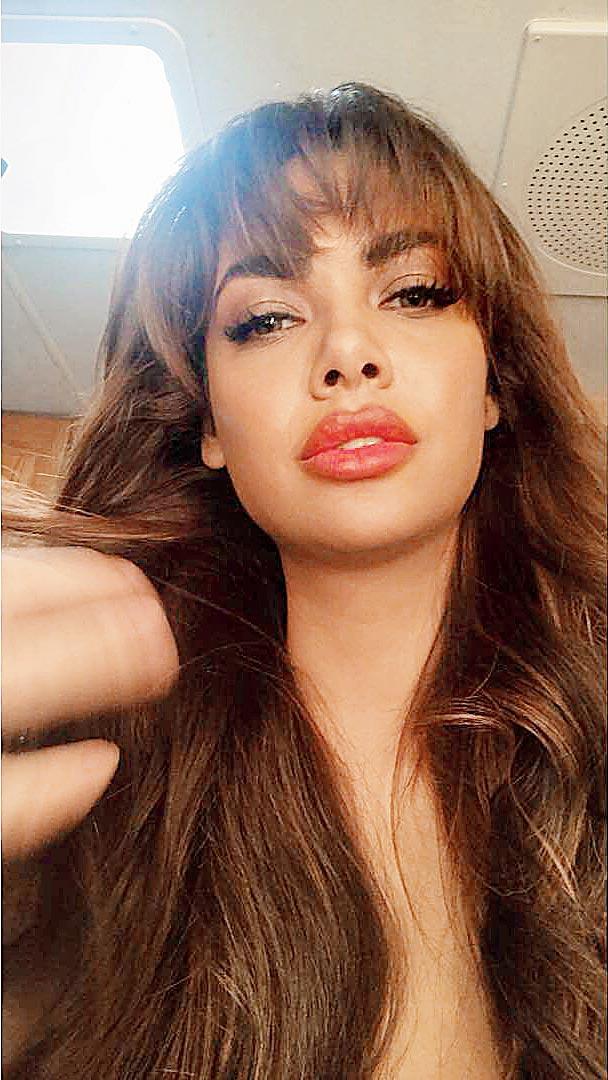 Has Esha Gupta done something to her lips?