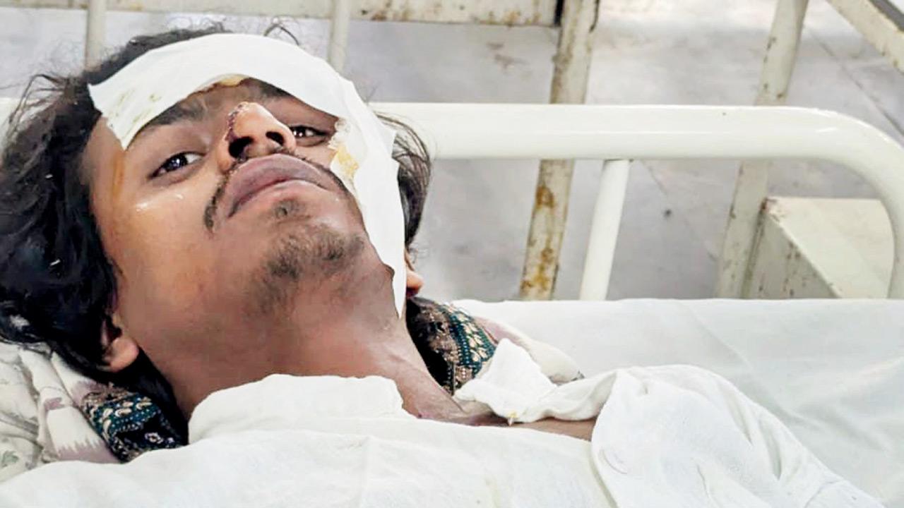 Kurla Bus Crash: ’Two Seconds Later, I Wouldn’t Be Alive,’ Survivors Recall the Horror